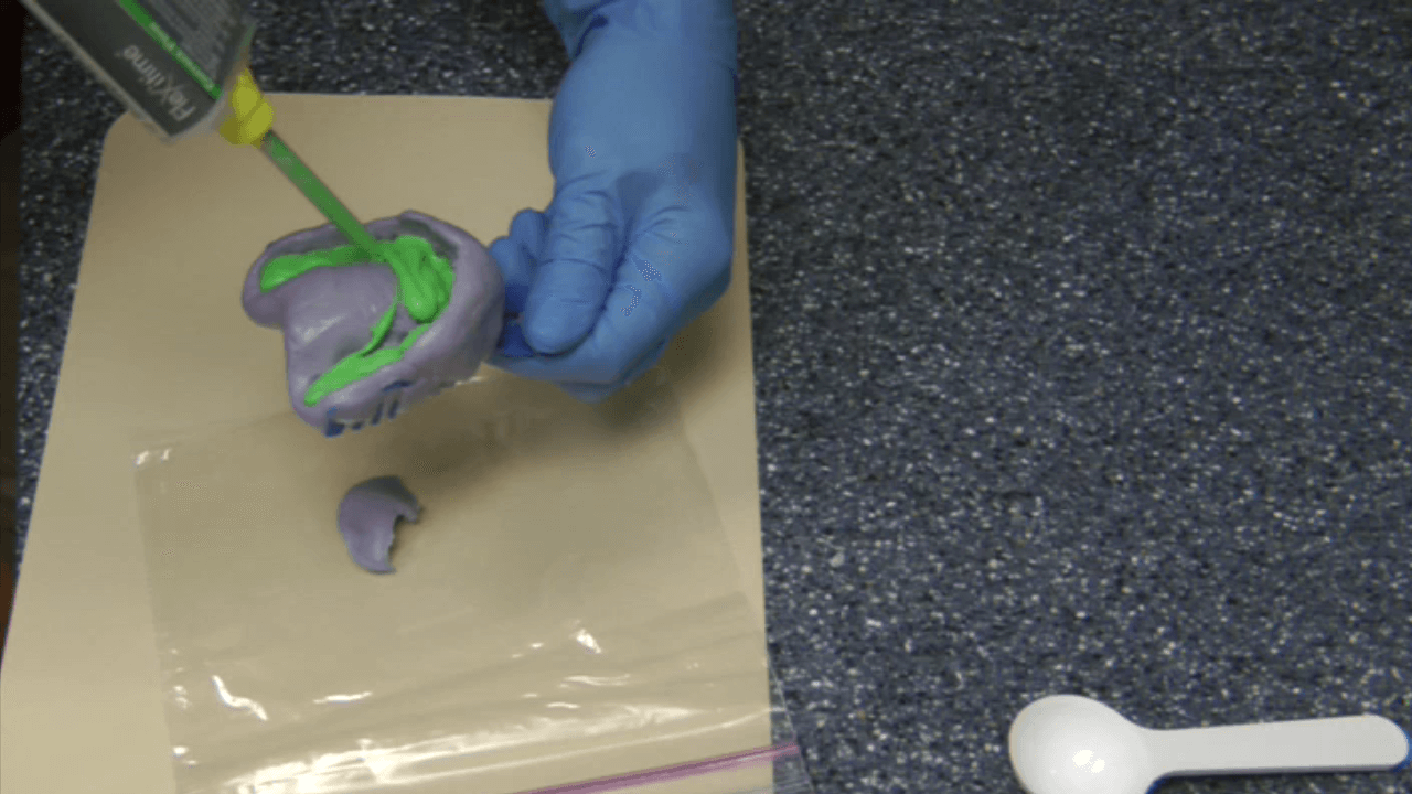 Putty Wash Diagnostic Impressions: Why & How? - Restorative Nation