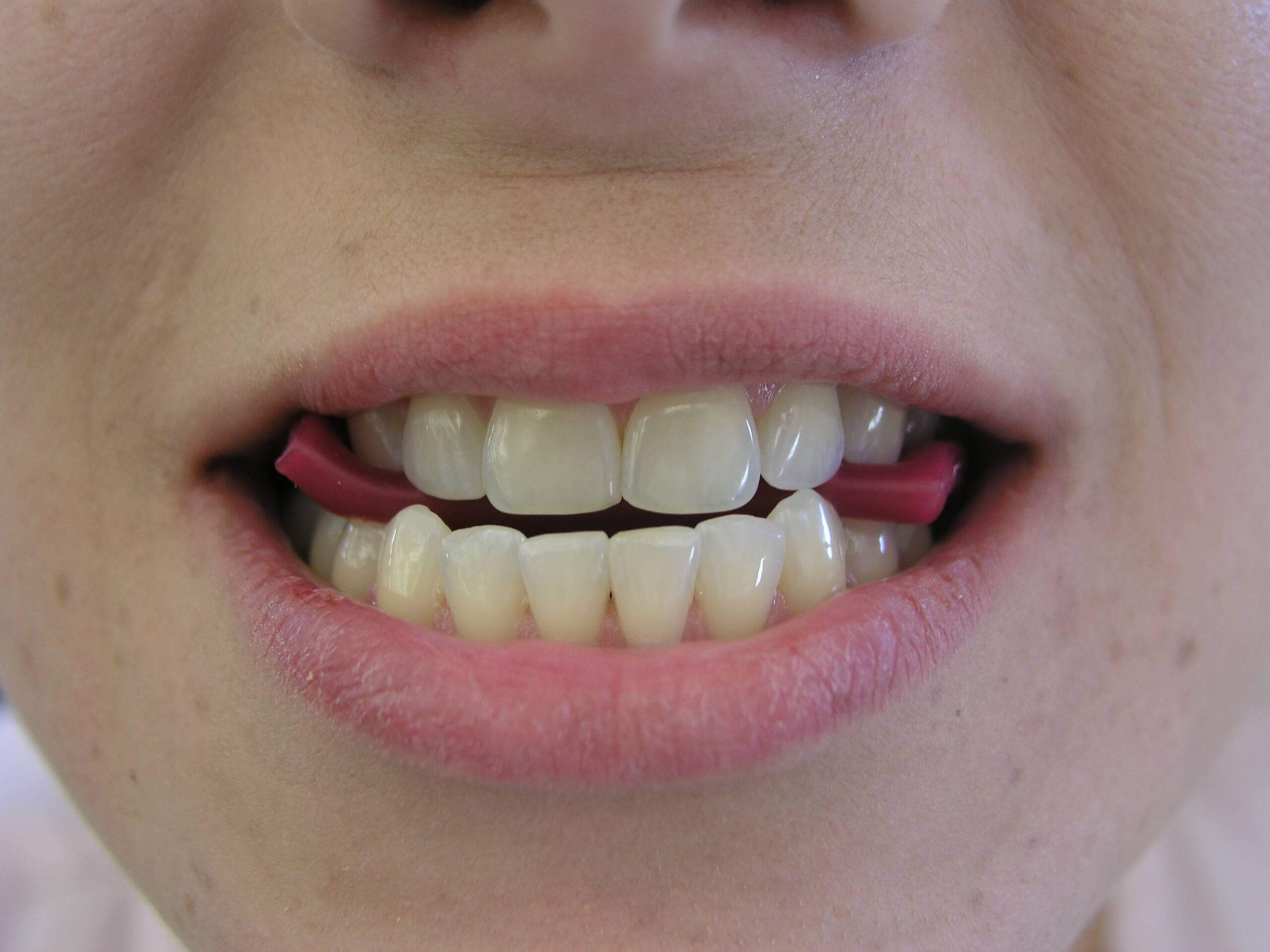 Capturing A Protrusive Record - Restorative Nation