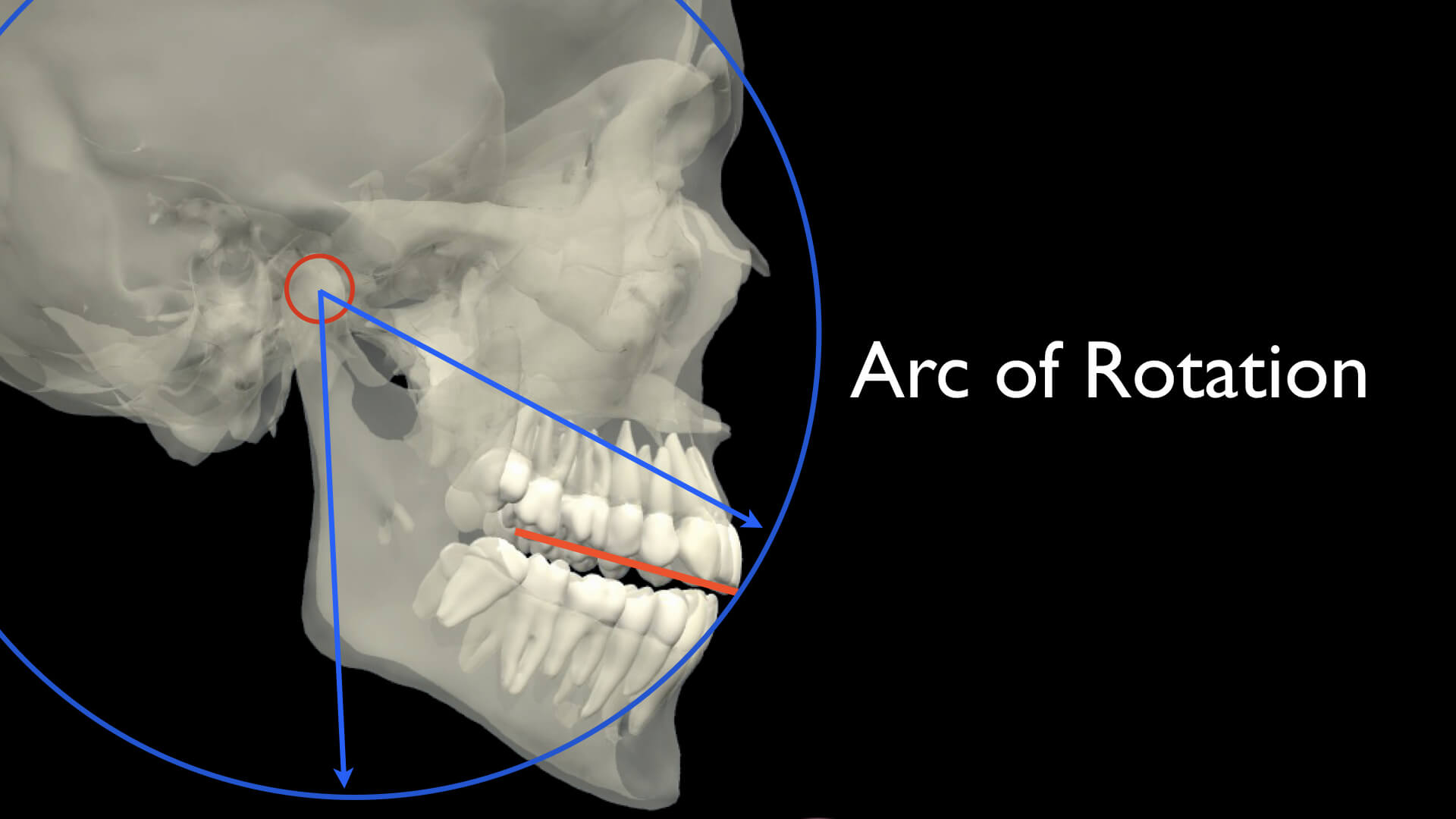 Arc of Rotation And Heavy Posterior Contacts - Restorative Nation