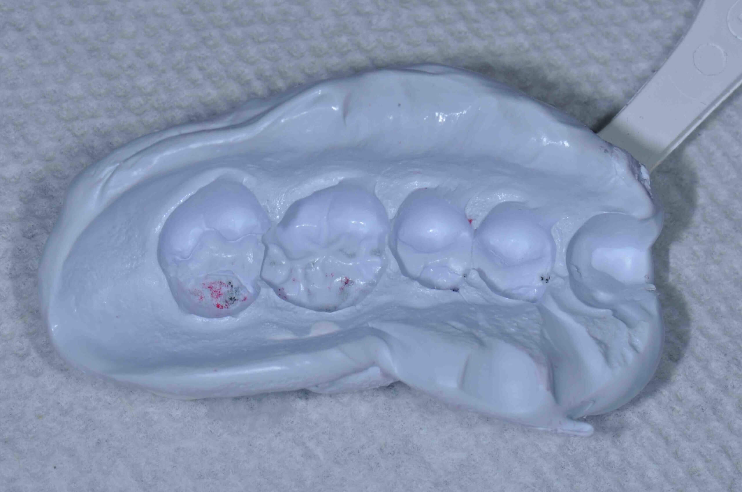 The Key to Provisional Matrix Success - Restorative Nation